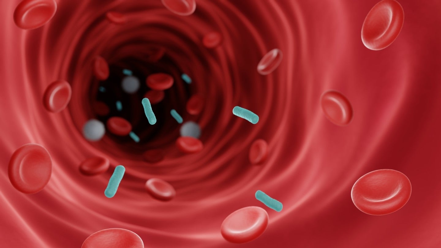 BD to advance bloodstream infections testing in Poland