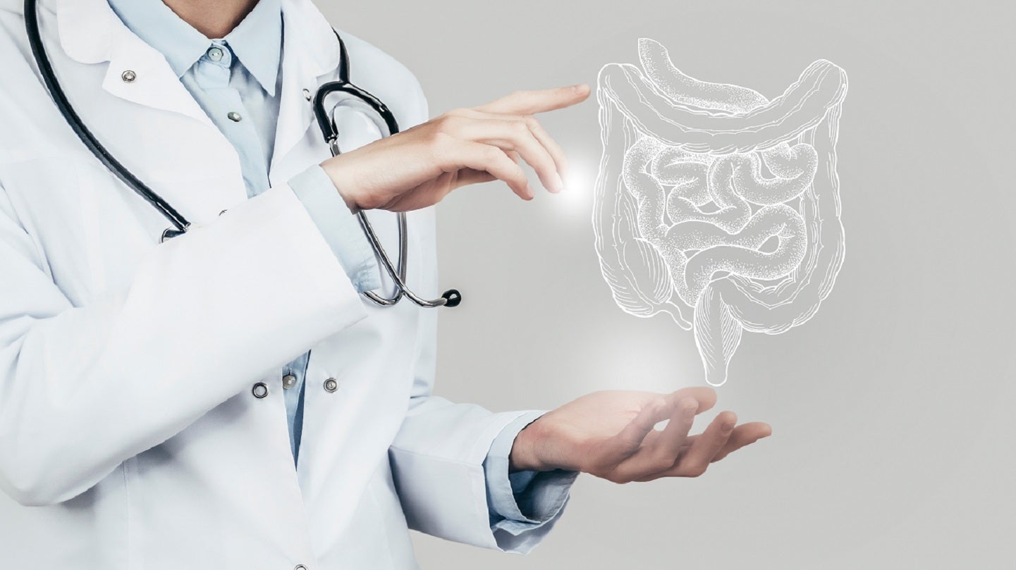 Intelligent Scopes develops AI tool for colon cancer detection