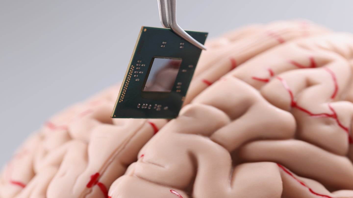 Brain implant companies unite to launch new industry group - Medical ...