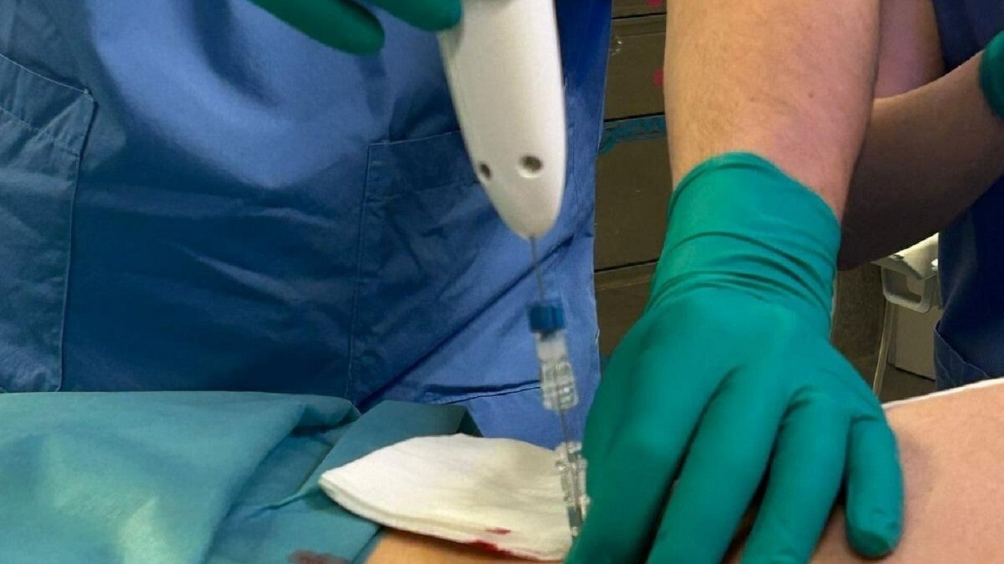 Single Pass’ Kronos biopsy closure device secures FDA clearance