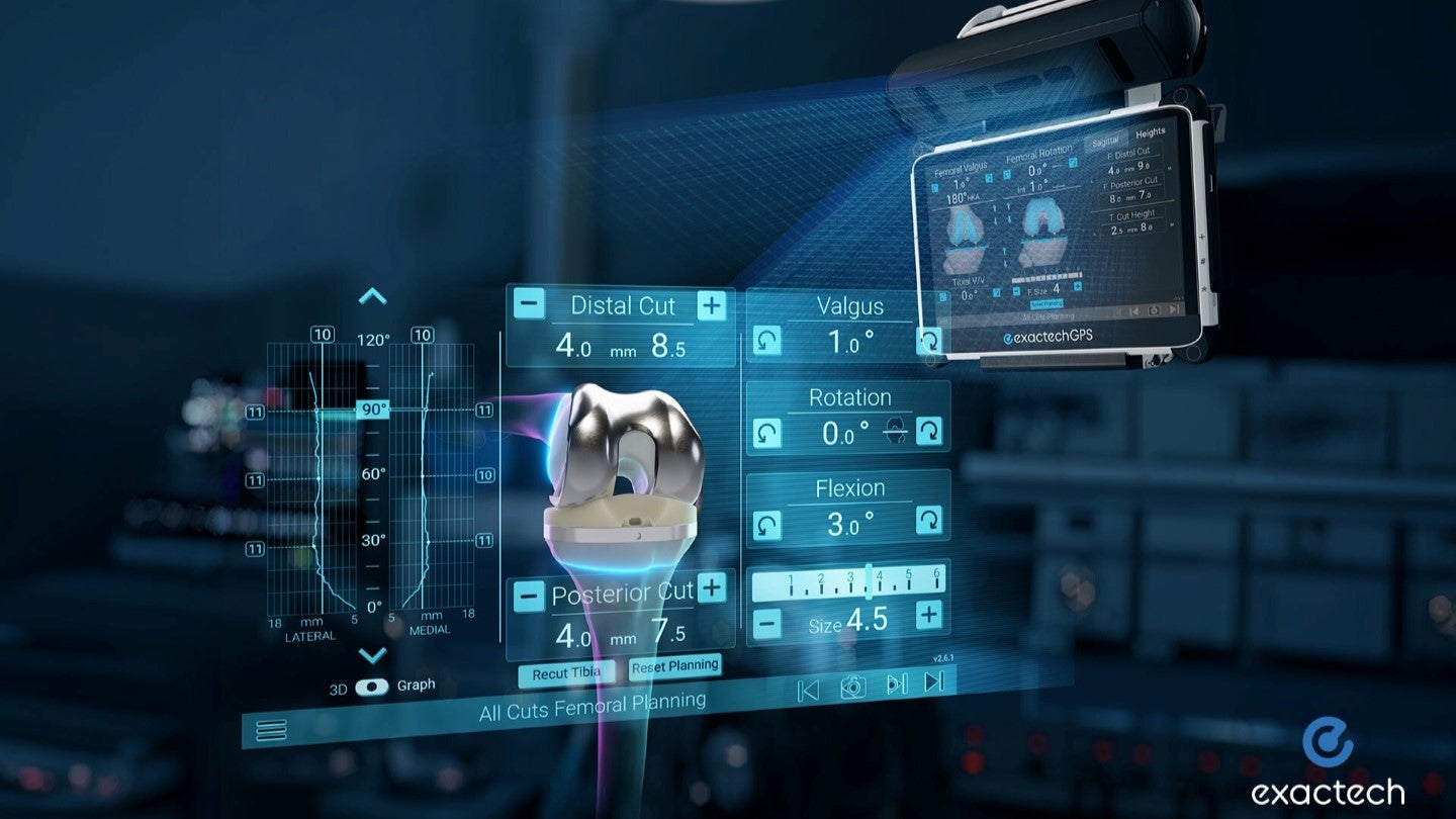 Exactech launches new knee replacement software ExactechGPS