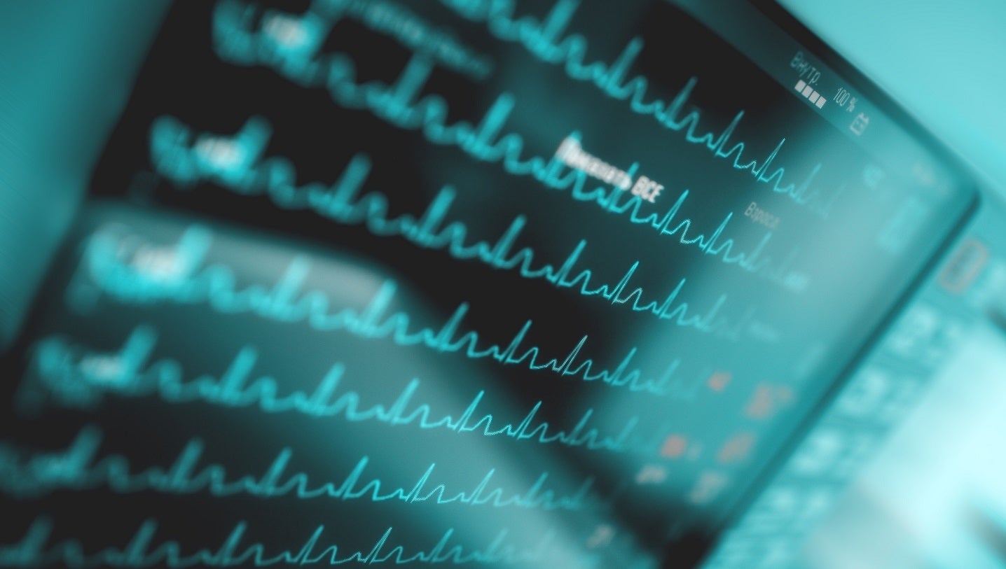 Clario secures FDA 510(k) clearance for SpiroSphere