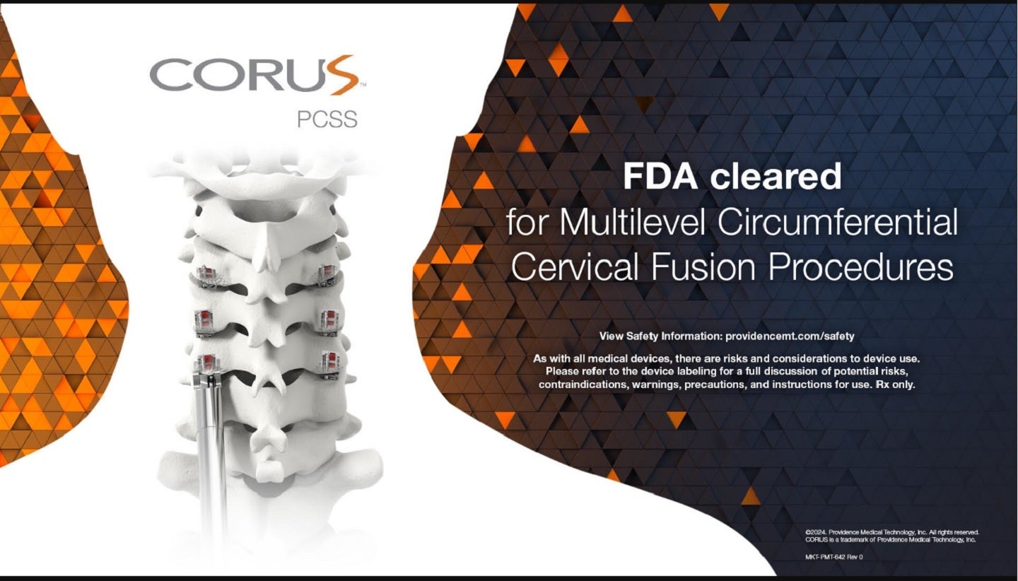 US FDA clears Providence Medical’s CORUS PCSS in cervical spine surgery