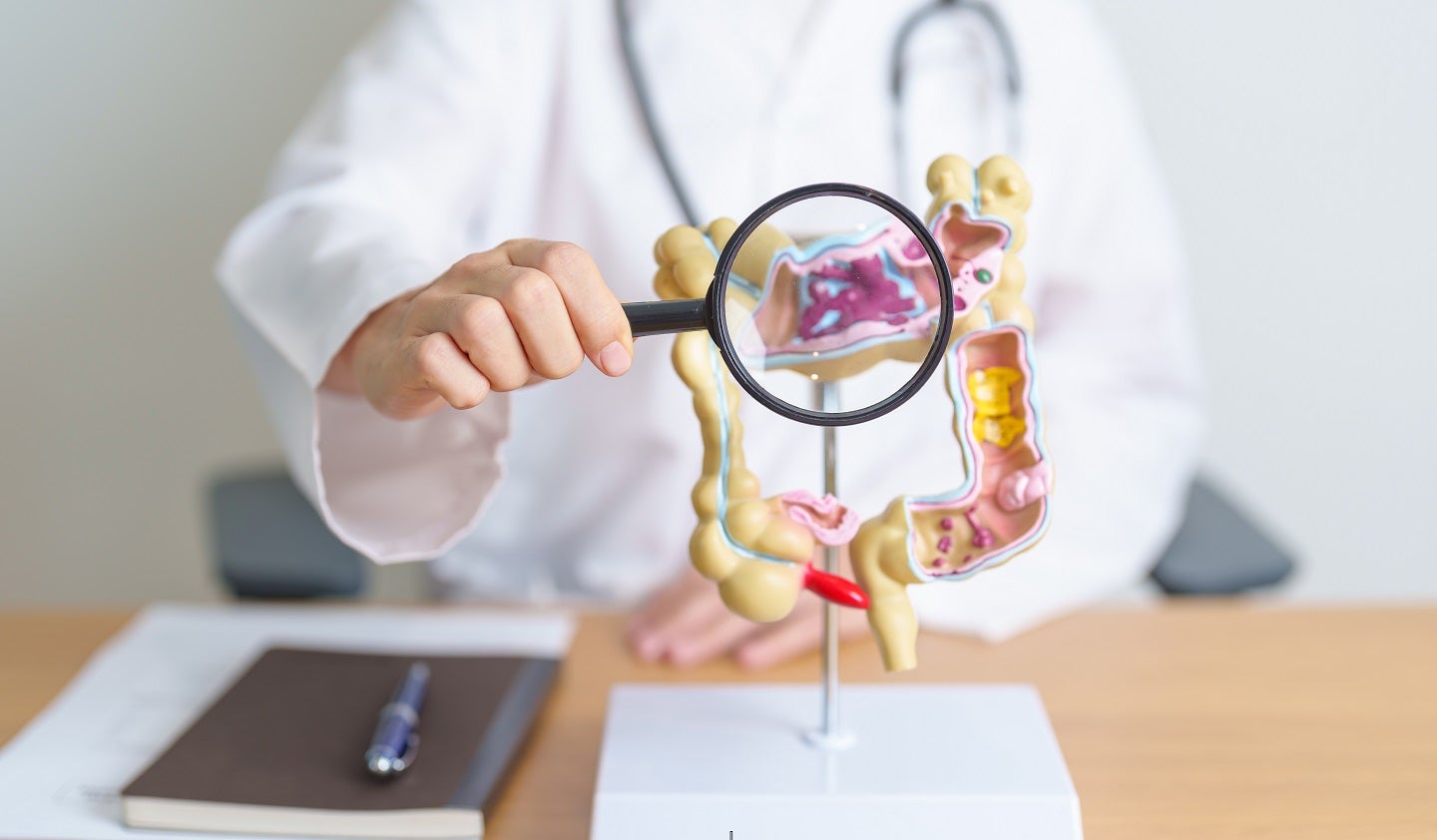 Mainz Biomed seeks FDA breakthrough device status for CRC test