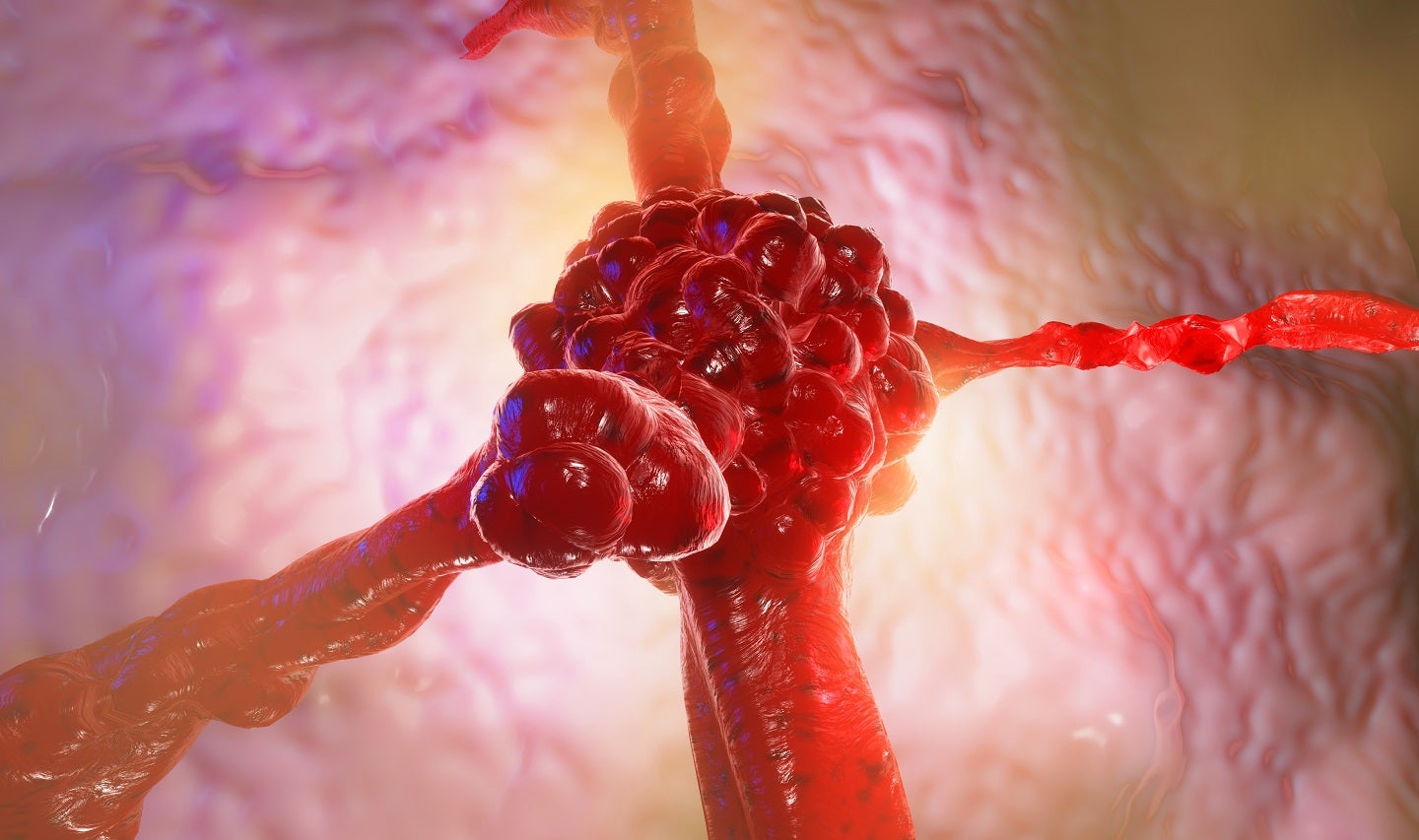 Lumicell obtains new CPT code approval for cancer surgery imaging