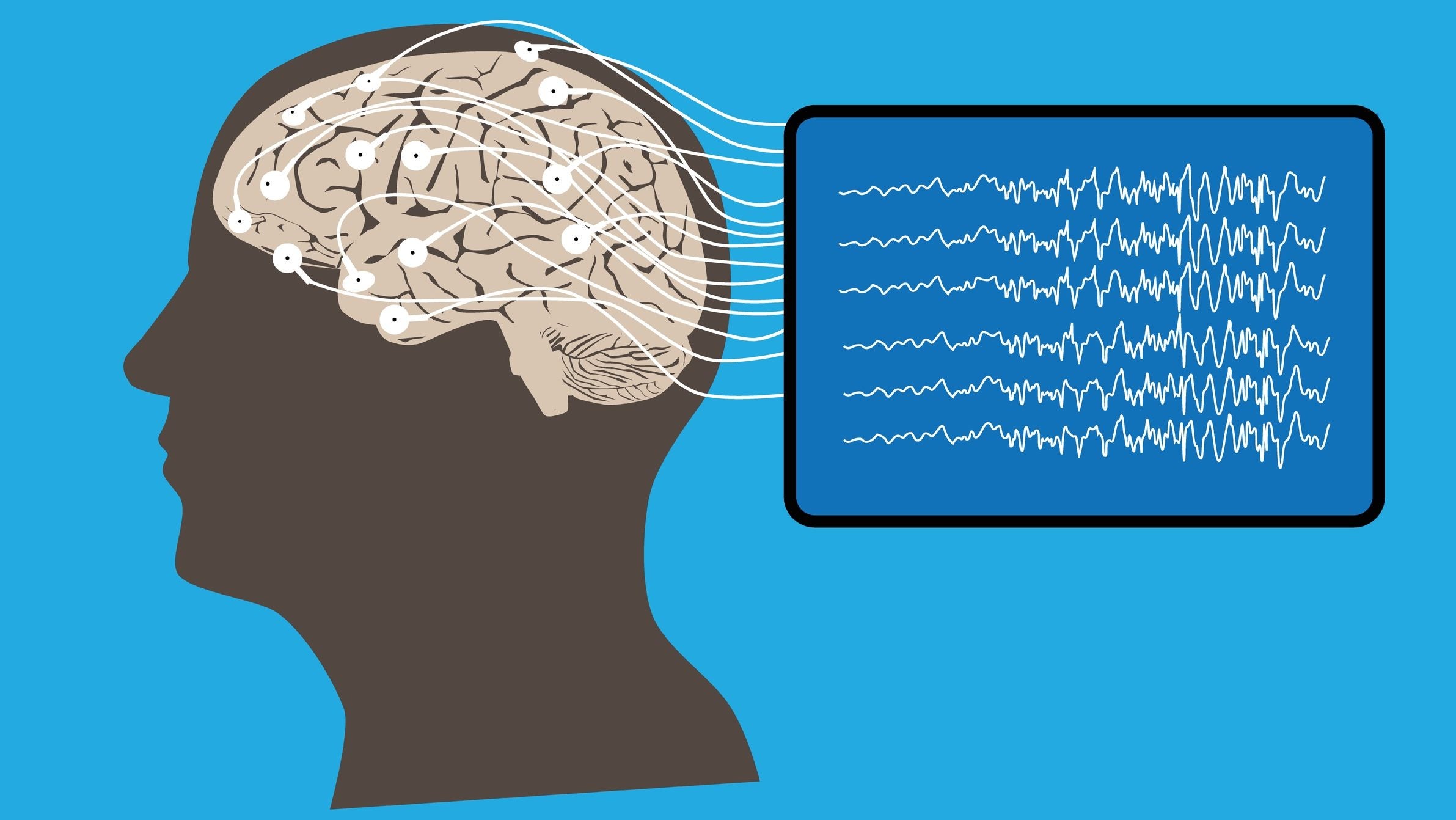 Ceribell’s AI EEG system reduces stay in ICU, study finds - Medical ...