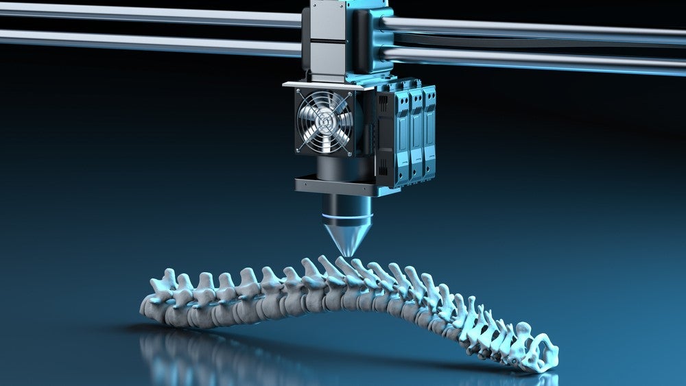 NanoHive raises $7m to develop 3D-printed spinal fusion devices