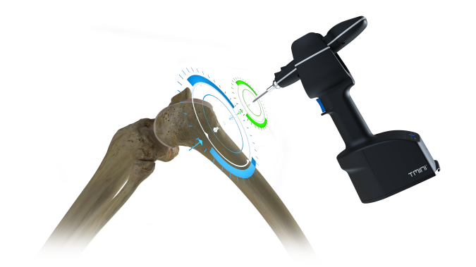 THINK Surgical's TMINI® Miniature Robotic System: Advancing Robotic ...