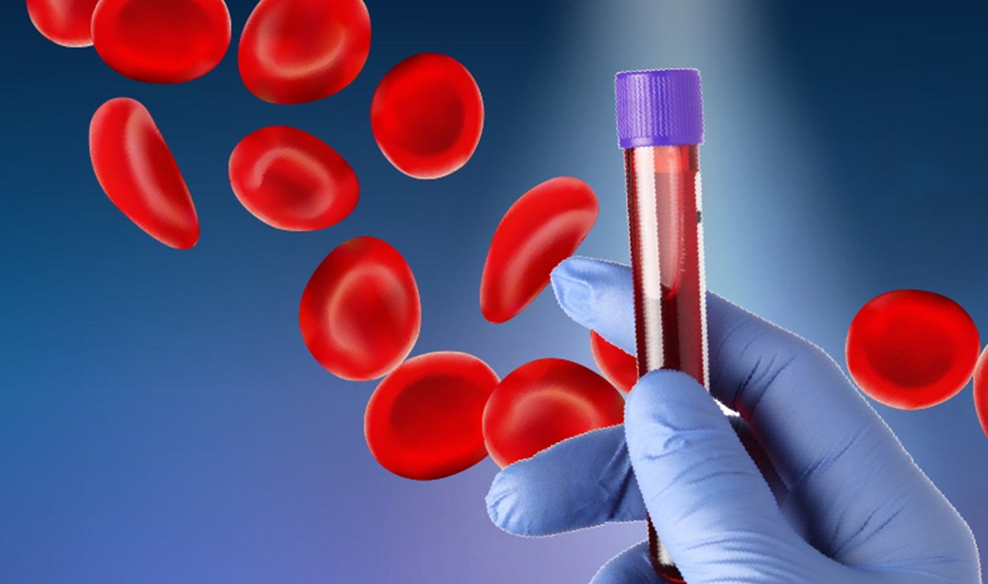 IDT launches Archer VARIANTPlex lymphoma panel