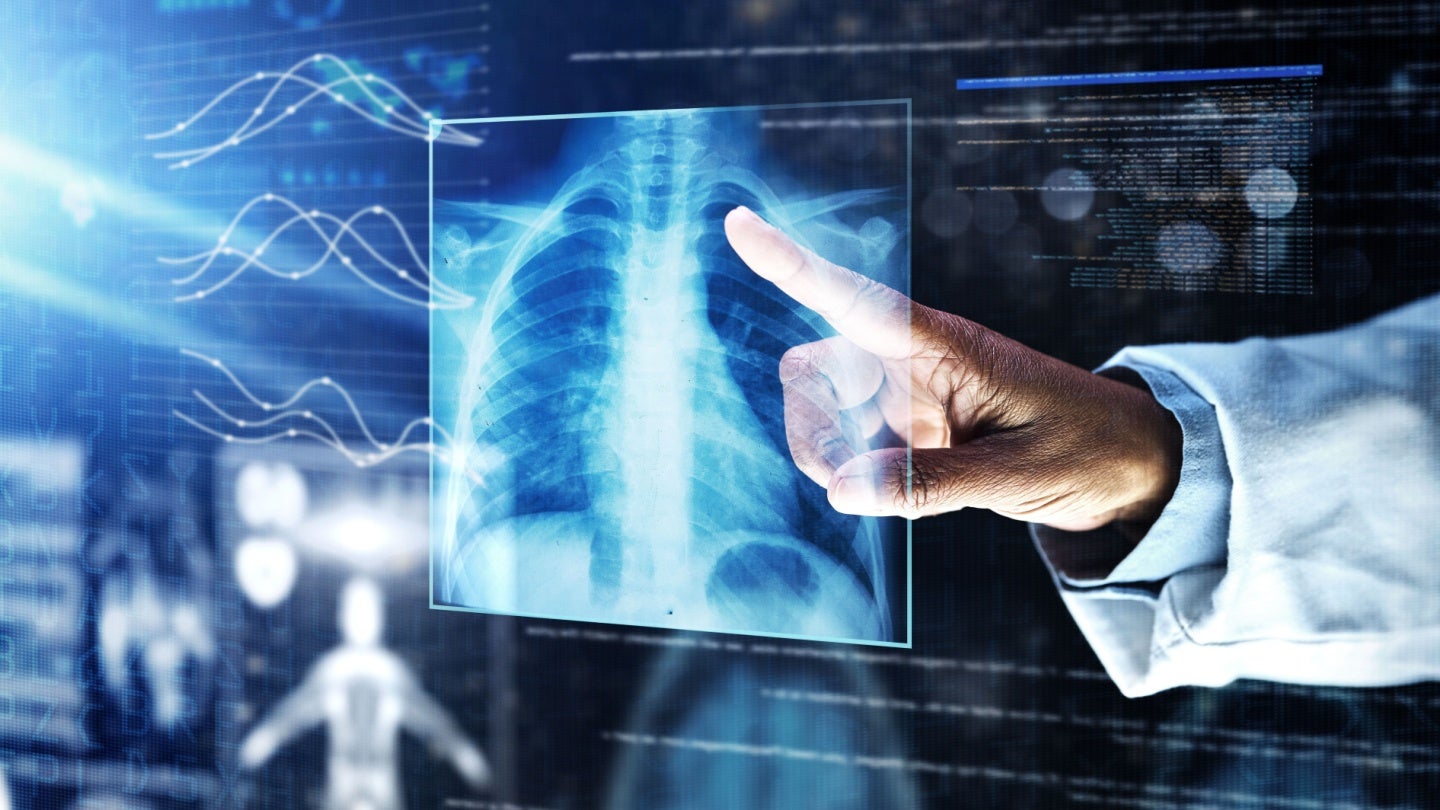 ARC and Roche collaborate to enhance NSCLC diagnostics