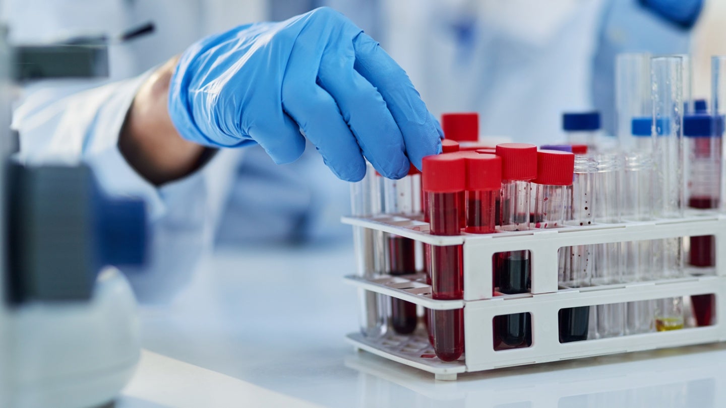 Veravas, Phanes Biotech to develop tau pathology test for Alzheimer's