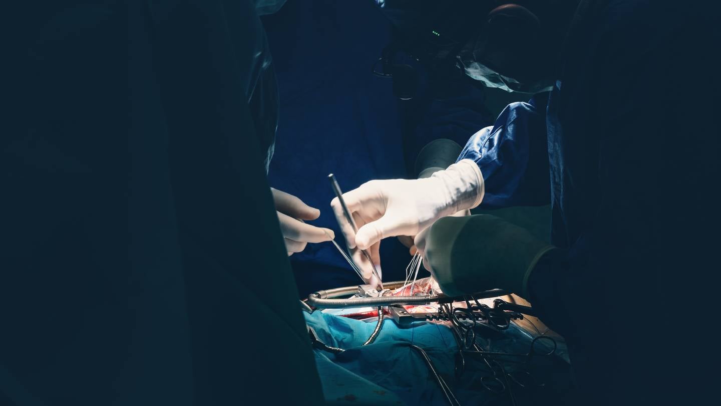 Edwards Lifesciences announces positive results in one year TAVI trial ...