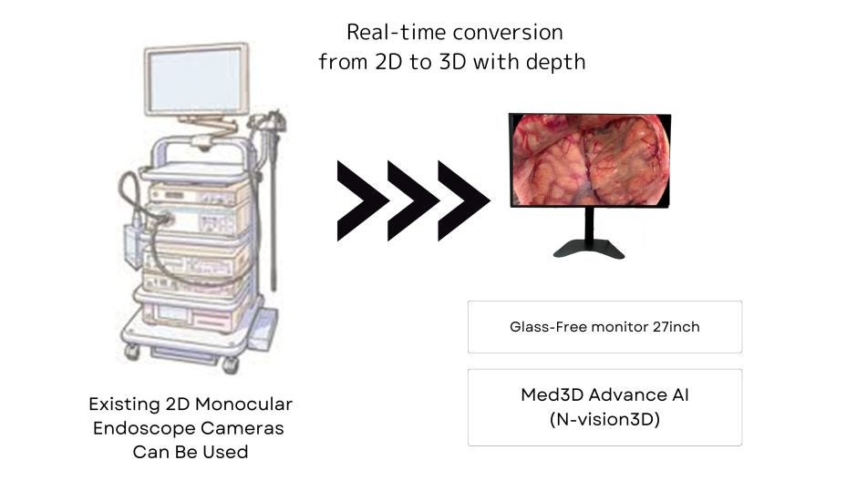 Novius Wins Innovation Award for Pioneering Real-Time 3D Medical ...