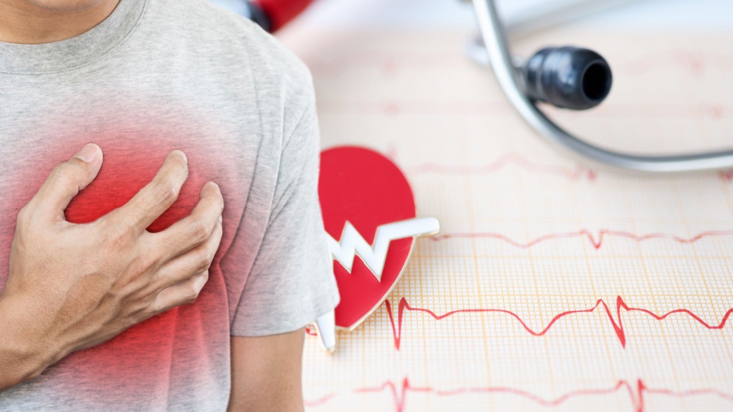 Abbott completes LBBAP procedures with AVEIR system