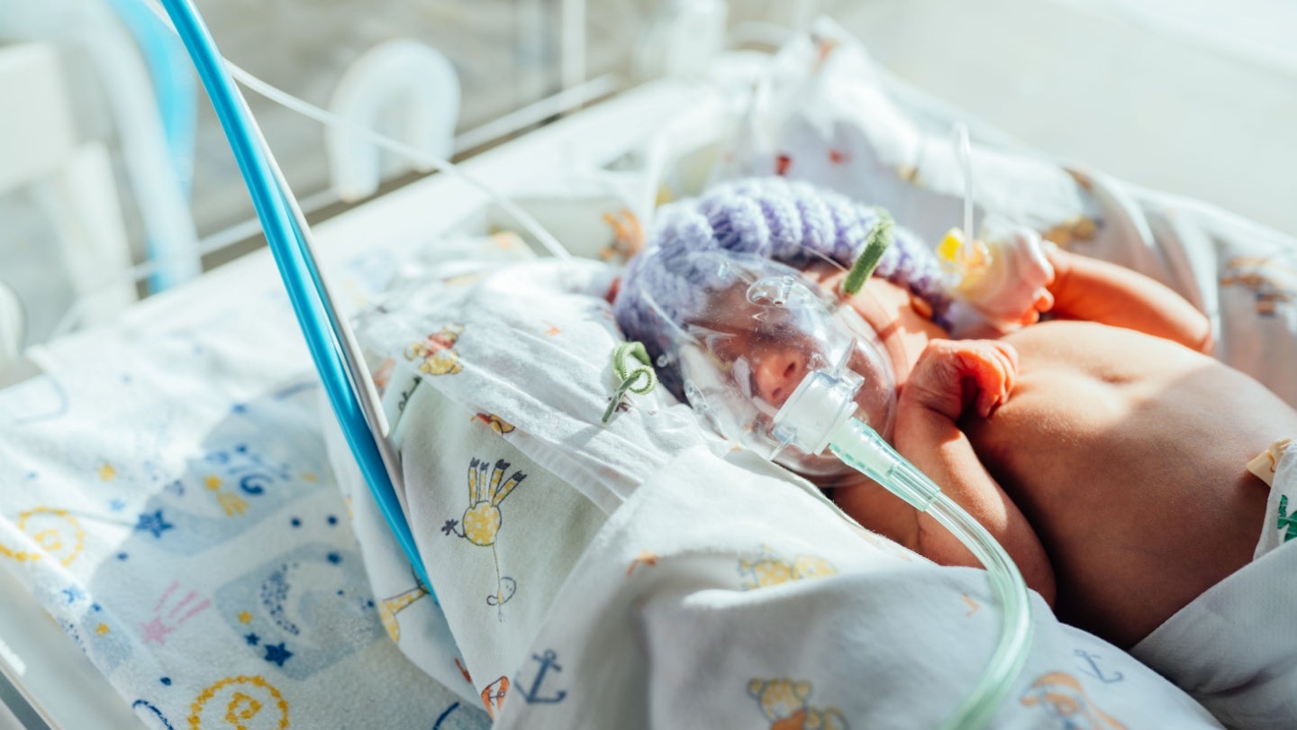 Beyond Air’s LungFit PH system gains European CE mark approval