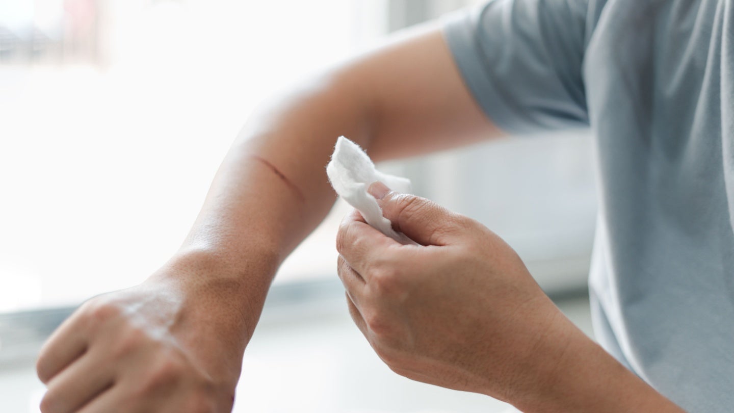 Imbed Biosciences announces Terry Bromley as new CEO