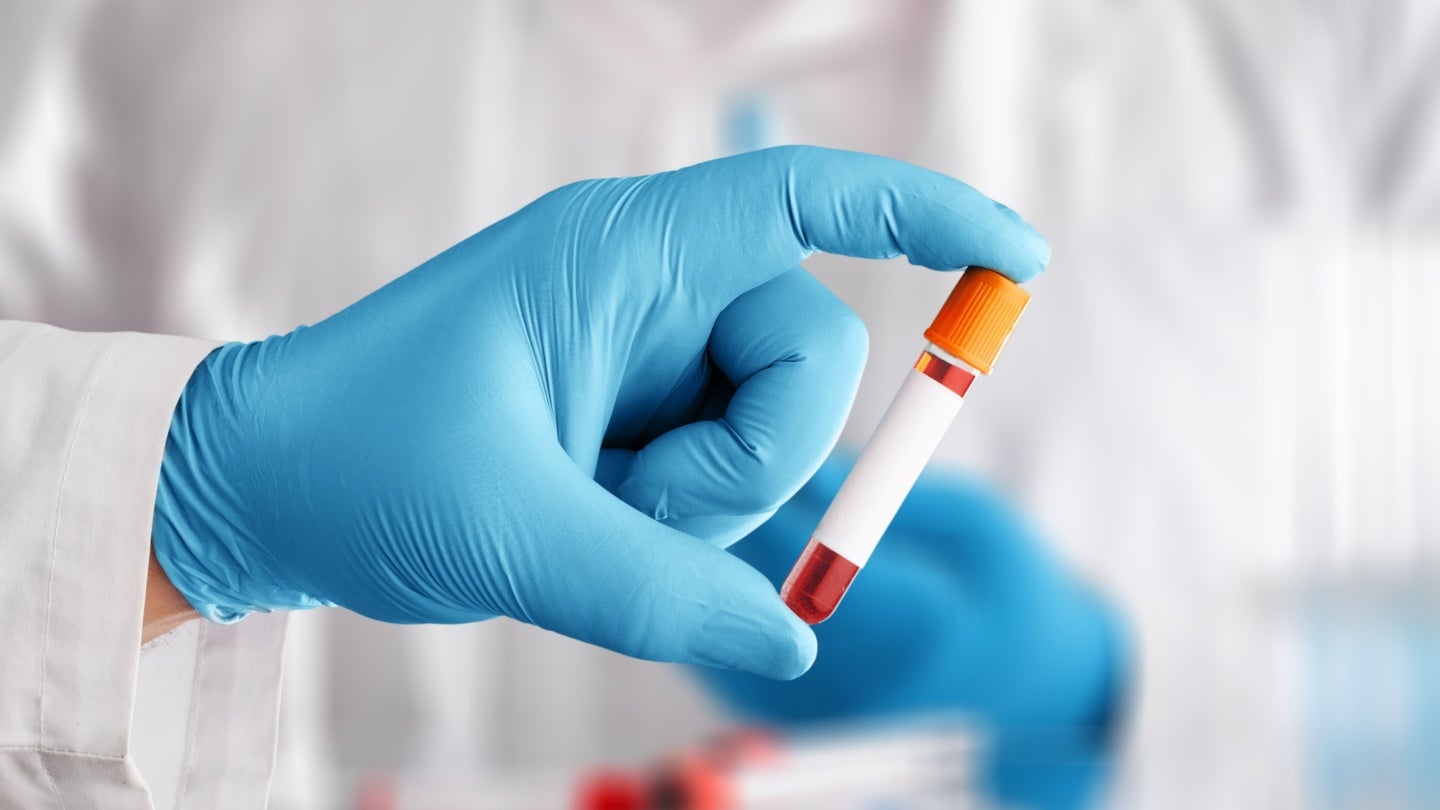 Doherty and RMIT cancer screening blood test for leukaemia