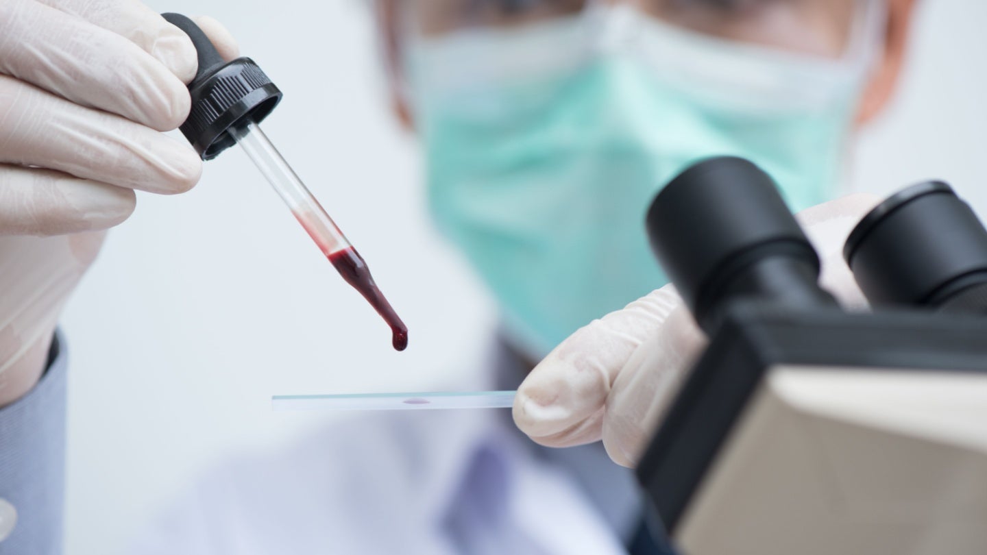 FDA grants breakthrough device designation to deepull’s BSI Test