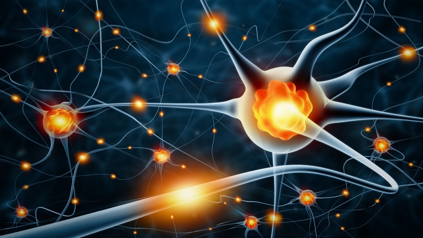 FDA grants MRI conditional label extension for Nalu Medical's ...