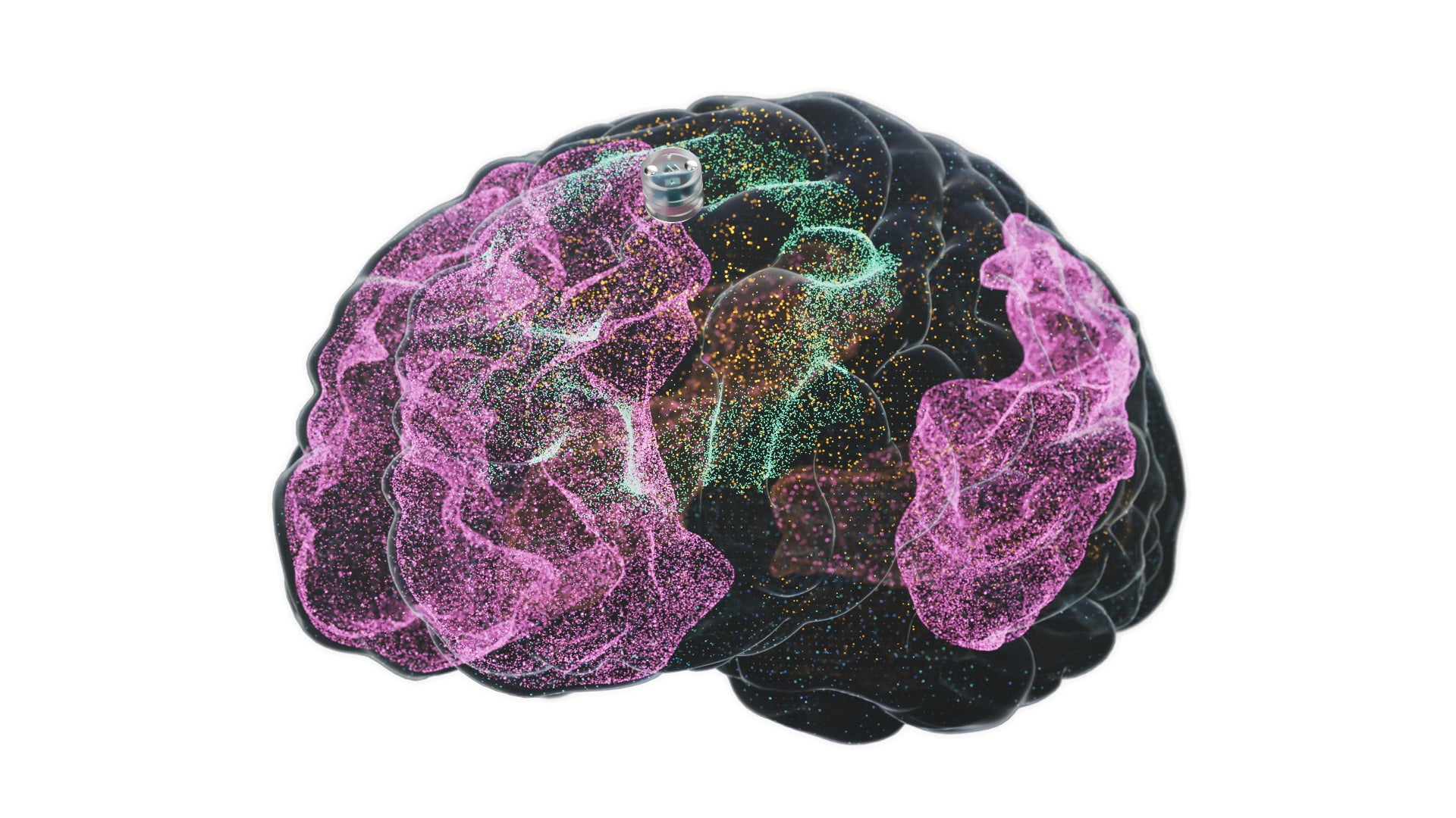 Motif Neurotech wins UK Government grant to advance BCI tech - Medical ...