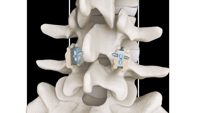 SC MEDICA's FFX® Technology: Award-Winning Innovation and Safety in ...