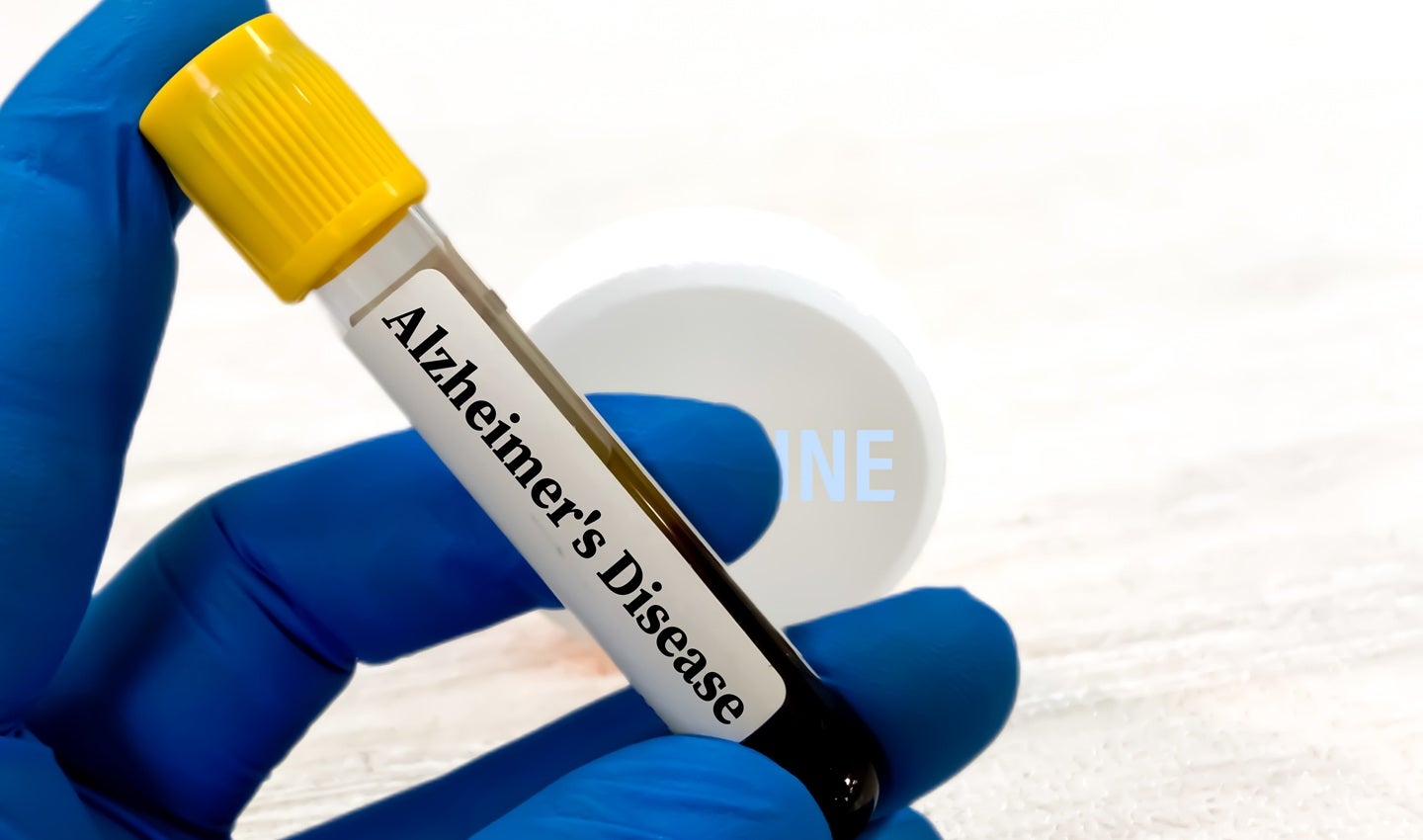 Roche’s Elecsys pTau181 test wins CE Mark to rule out Alzheimer's