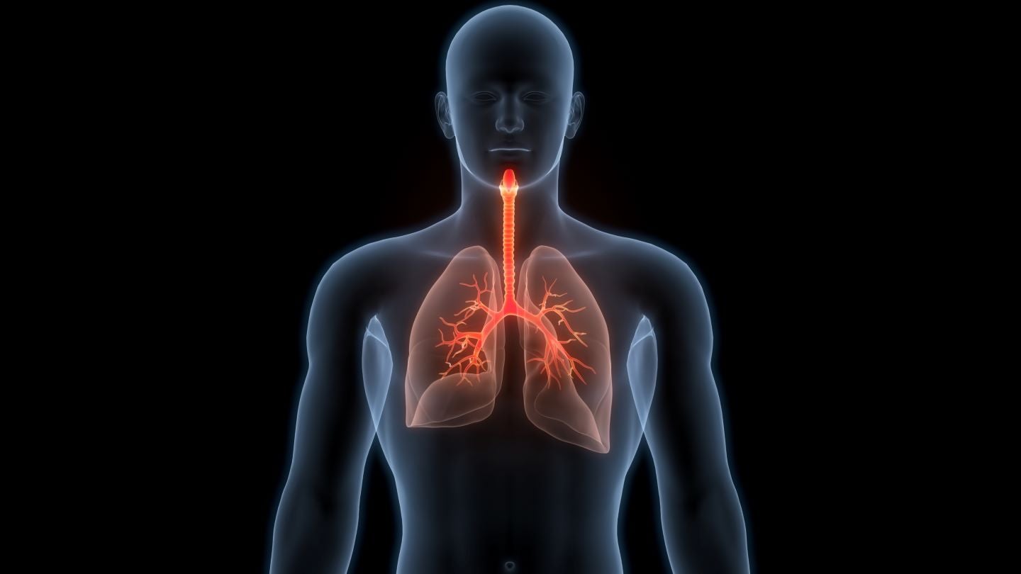 EDX Medical develops rapid pneumonia test for hospital patients ...