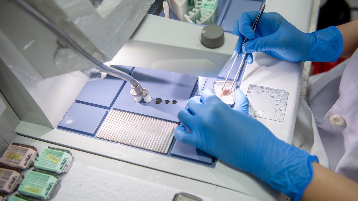 Mopec to enhance pathology workflows with Lumea technology