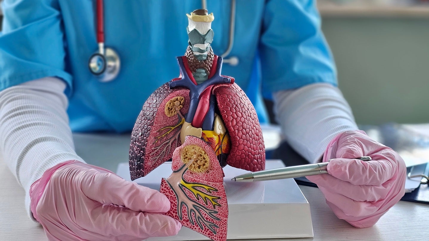 LEX Diagnostics secures FDA clearance for VELO PCR system